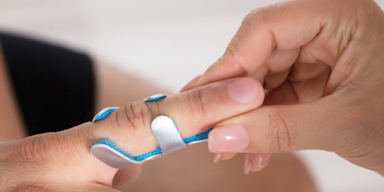 How to Tell if Finger is Broken or Sprained | The Orthopedic Clinic