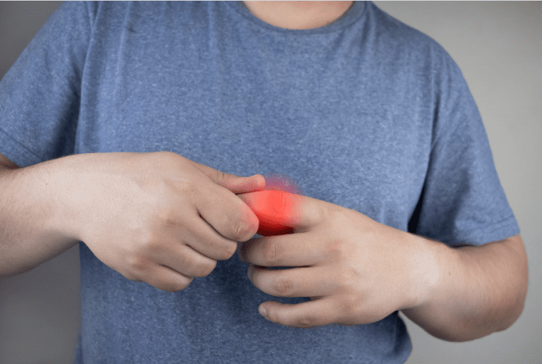 Trigger Finger: Symptoms, Causes, & Treatment